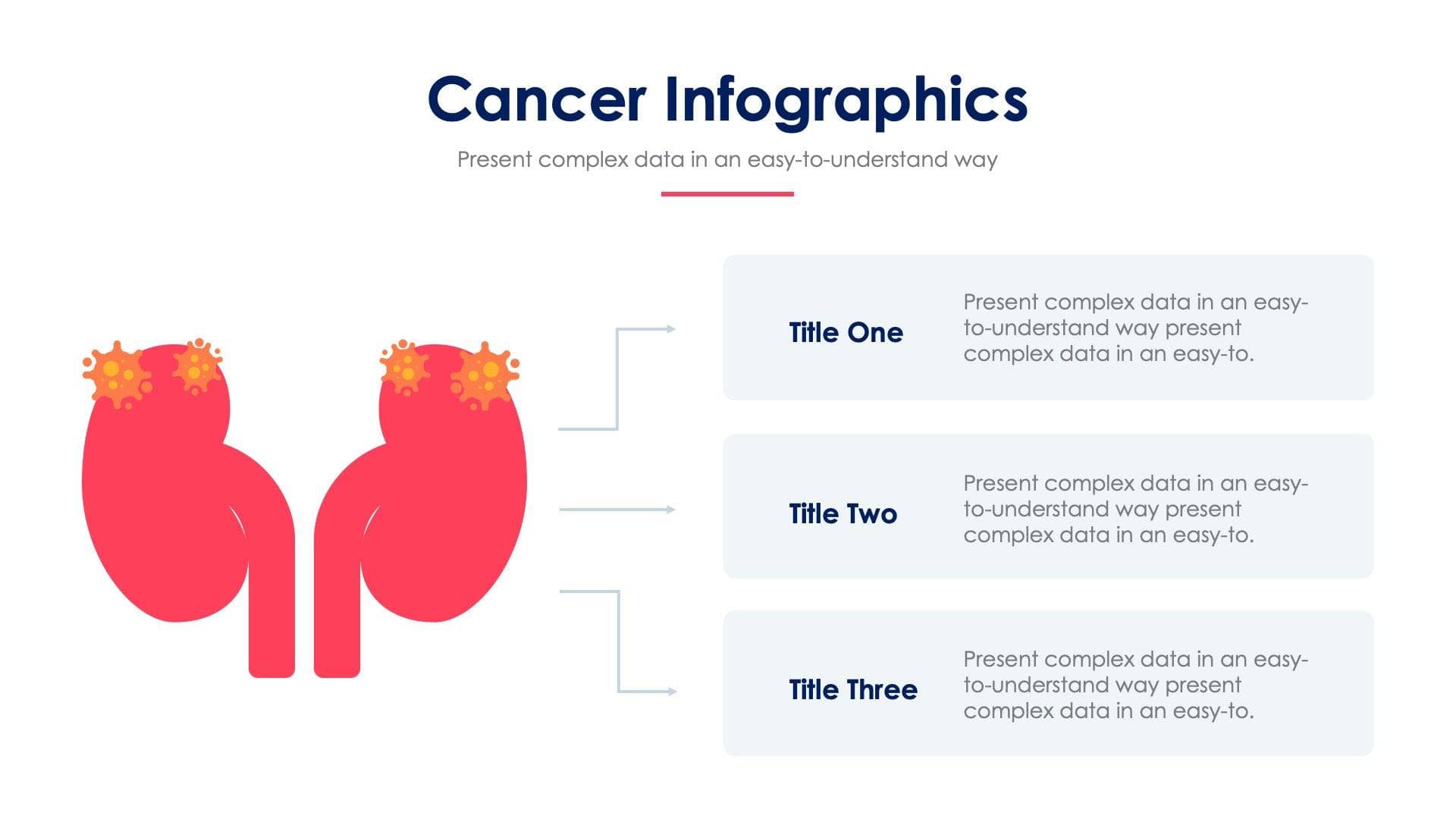 Cancer Slide Infographic Template S03272204 | Infografolio