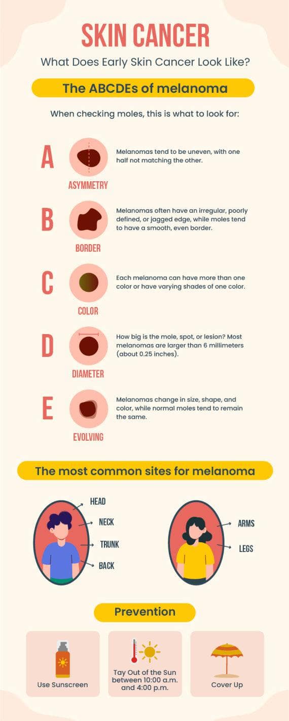 Beige Skin Cancer Health Infographic Template | Infografolio